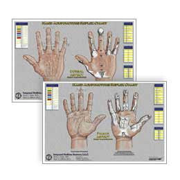 HAND THERAPY CHARTS – Acudepot